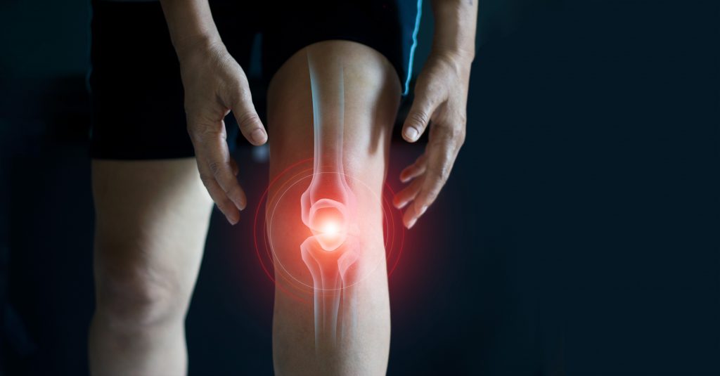 Diagnostico diferencial del dolor anterior de rodilla - Physio Network
