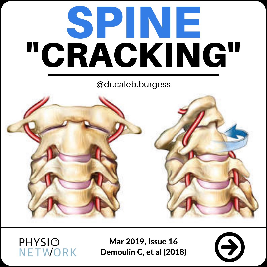 Spine "CRACKING" — Physio Network