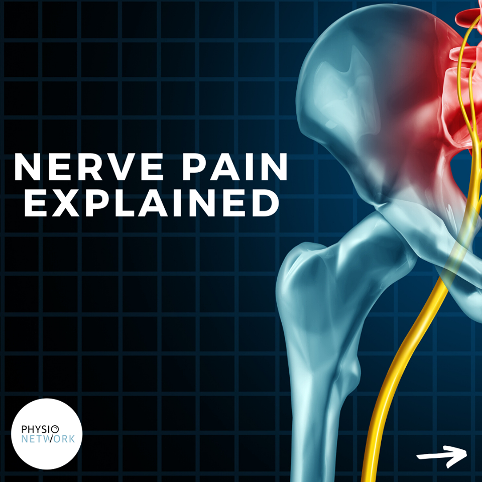 Nerve Pain Explained — Physio Network