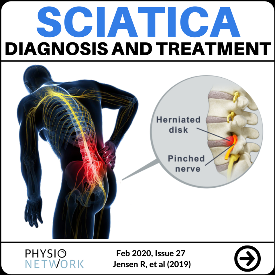 Sciatica — Physio Network