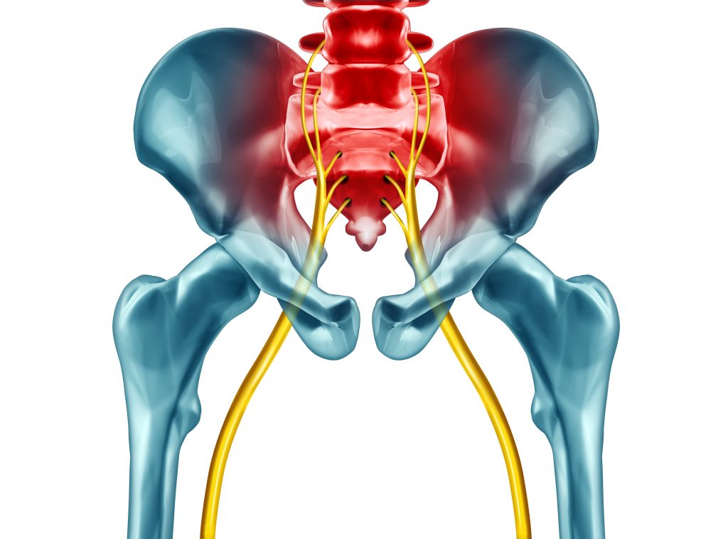 Differential Diagnosis Of Radicular Pain — Physio Network