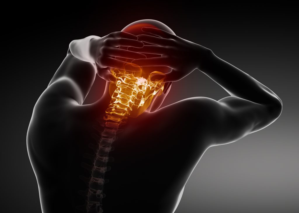 Diagnosing Cervicogenic Headache — Physio Network