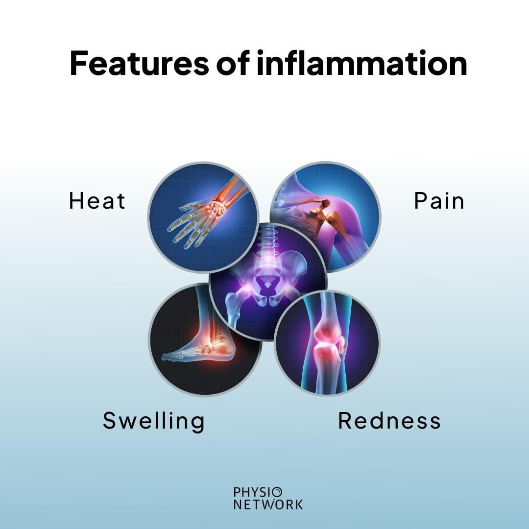 🔥 Common Features Of Inflammation — Physio Network