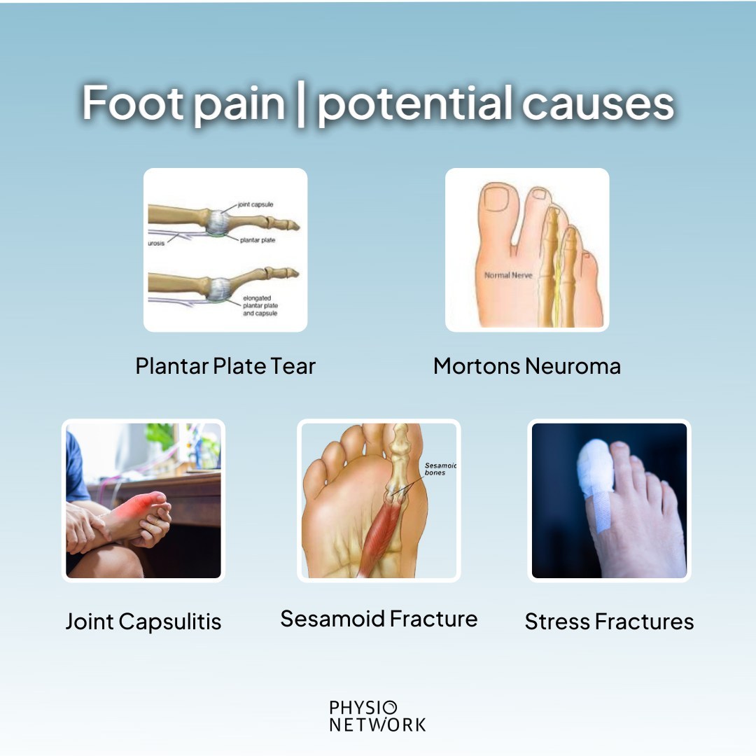 Infographics - Physio Network