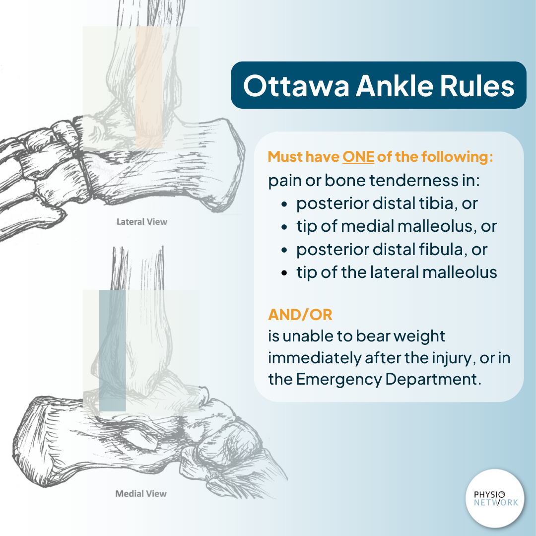 Ottawa Ankle Rules — Physio Network