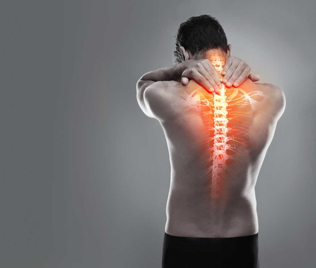 Vertebral Compression Fracture - A Complete Guide — Physio Network