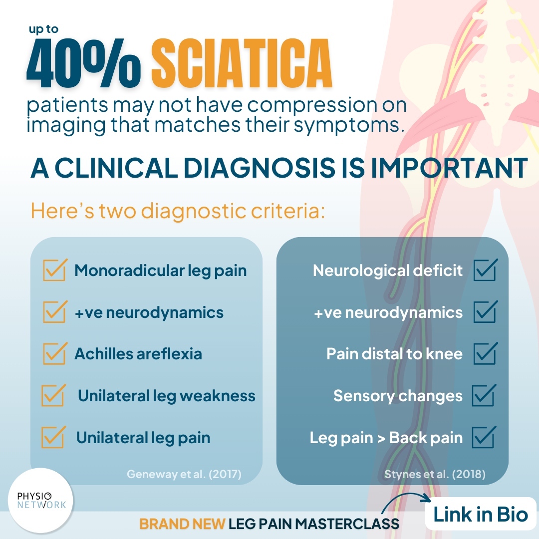 🕵 Diagnosing sciatica!⁠ - Physio Network