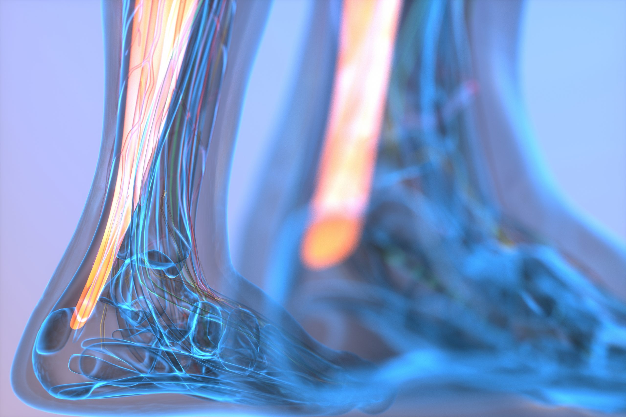 Decoding Achilles tendon rupture: Evidence and informed treatment ...