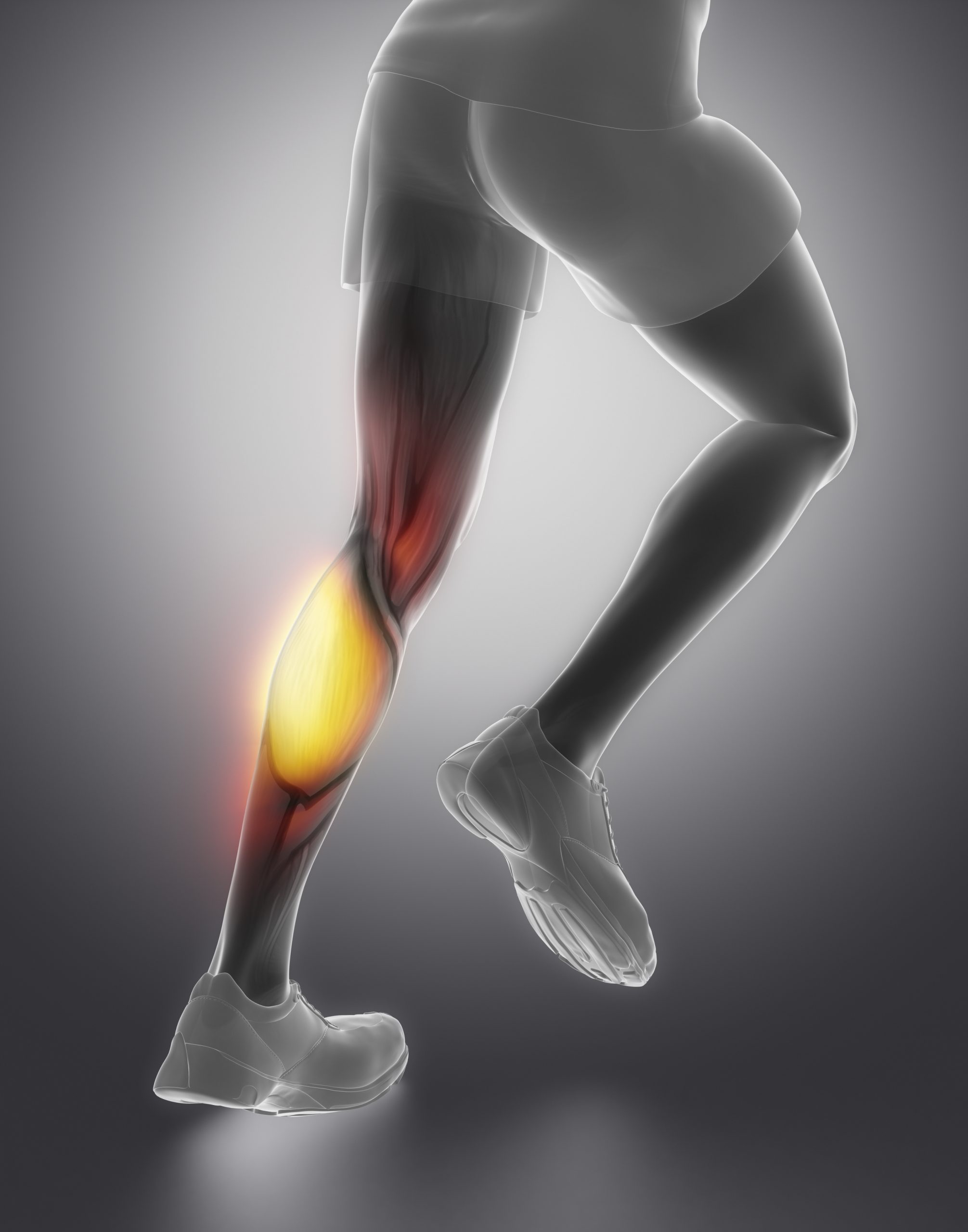 Calf Strain Rehab: From Research to Practice - Physio Network