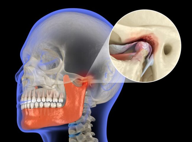 Temporomandibular Disorder (TMD) Assessment Made Simple — Physio Network