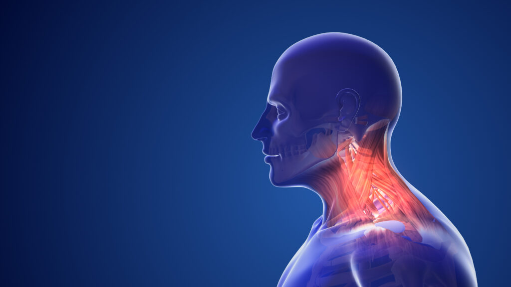 From Research To Practice: Navigating Non-Specific Neck Pain — Physio ...